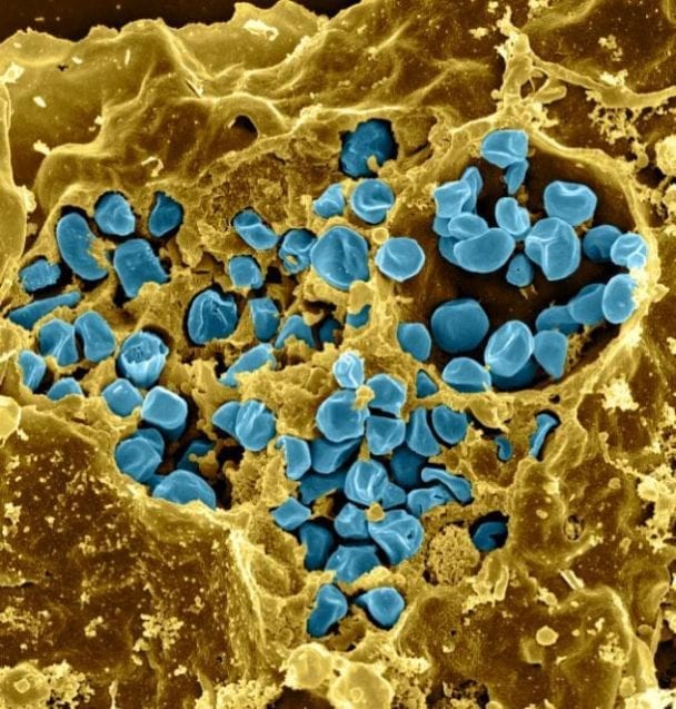 New Insights Into Tularemia Pathogen May Inform Next-Generation Medical ...
