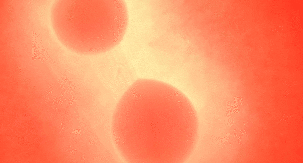 Scientists Identify a Mechanism of Epidemic Bacterial Disease