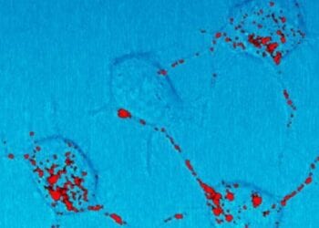 Prions - Global Biodefense