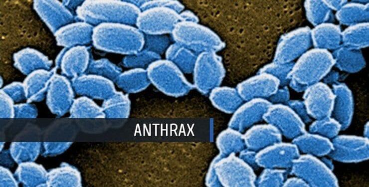 Soviet Anthrax Pathogen Genome Generated From Autopsy Specimens ...