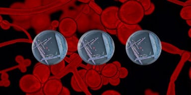 Support the Development of the WHO Fungal Priority Pathogens List