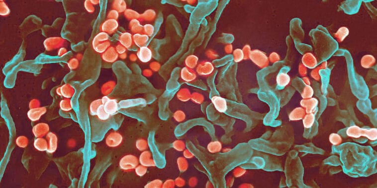 Early Clinical Signs of Severe Lassa Fever