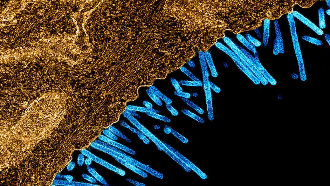 Two New Rubella-Related Viruses Discovered: Ruhugu and Rustrela ...