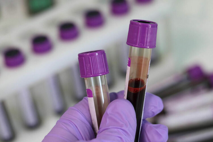 Biomarkers Identified to Predict Severe Dengue