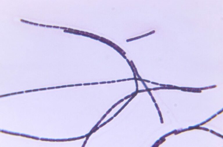 Elusys Therapeutics Finalizes HHS Contract to Deliver Inhalation ...