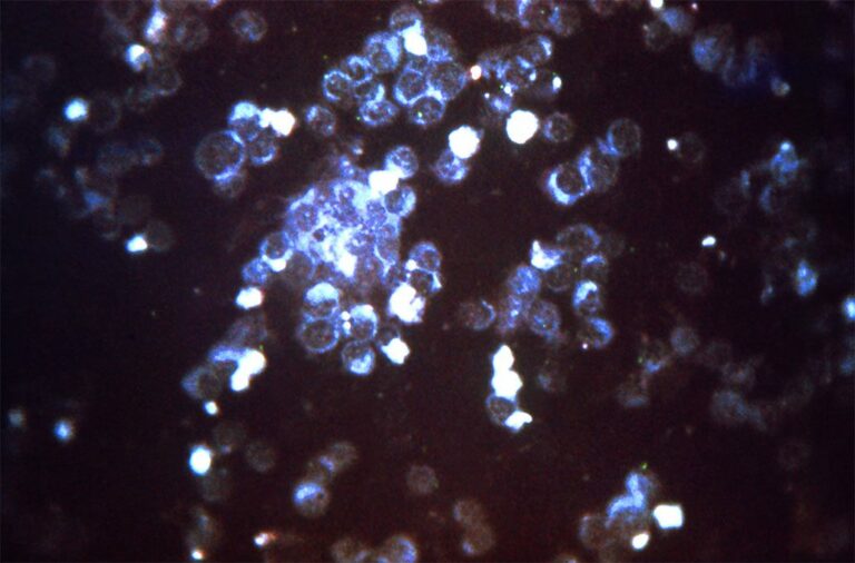 BD Gets FDA Clearance for Influenza, RSV, COVID-19 Respiratory Viral Panel