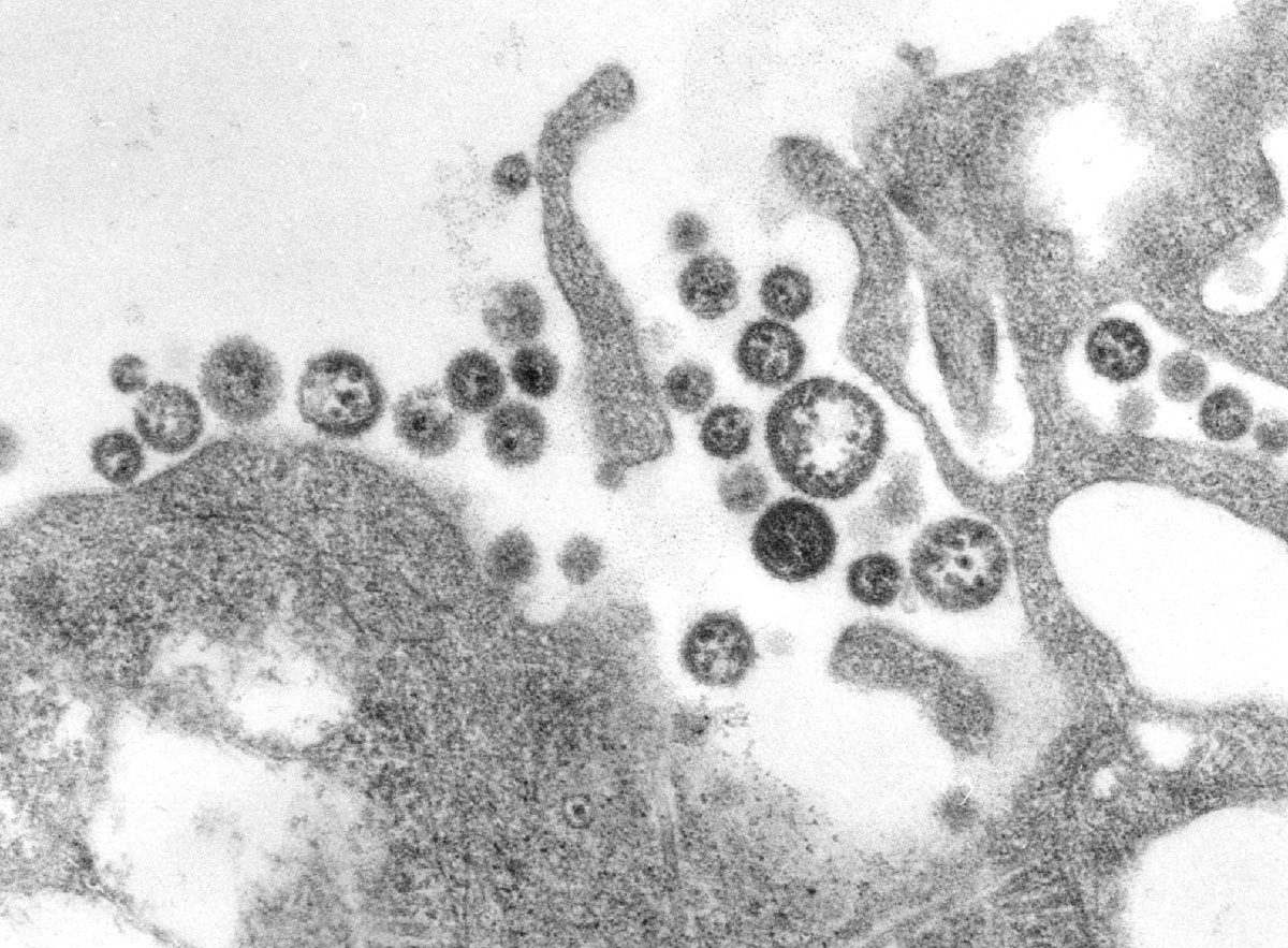 Primmune Therapeutics Awarded DTRA Funding for Lassa Fever Antiviral