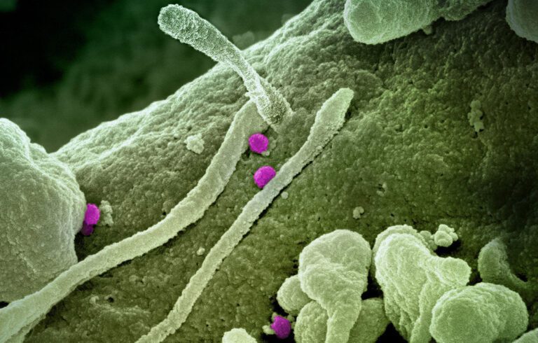 Crimean-Congo Hemorrhagic Fever Is Circulating Widely in the DRC