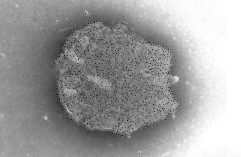 New Study Reveals Striking Differences in Disease Severity Between Two ...